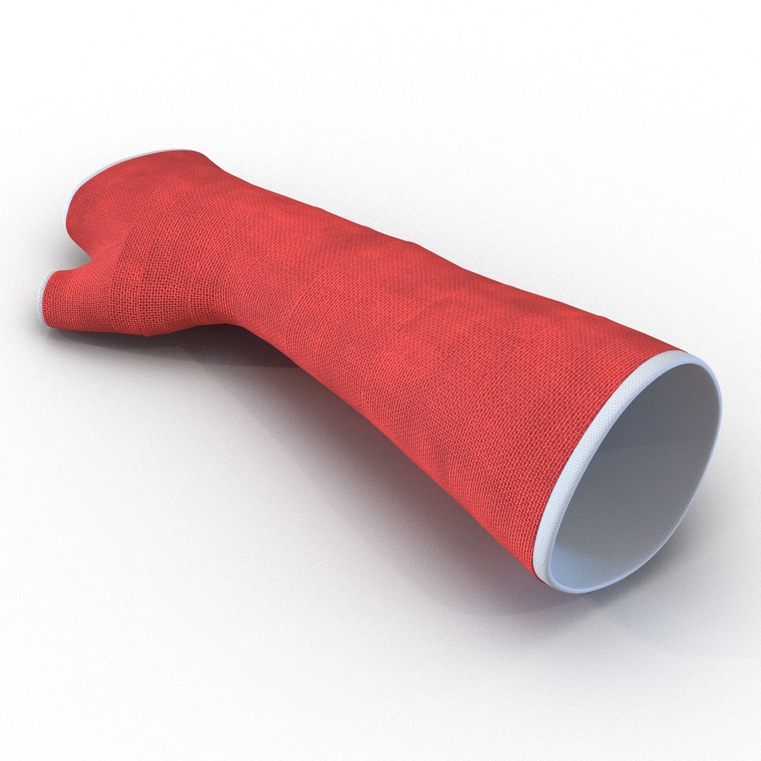 max orthopedic cast arm leg