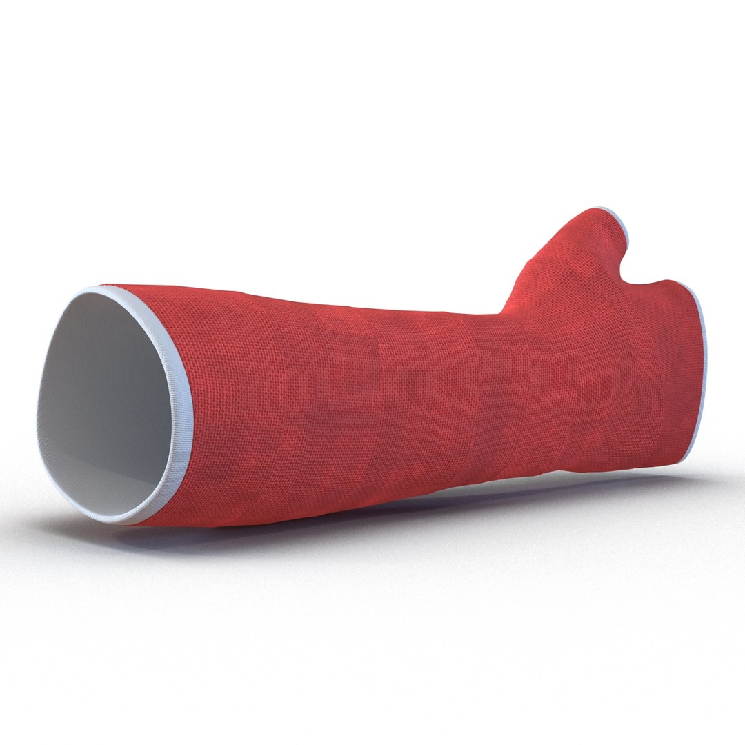 max orthopedic cast arm leg