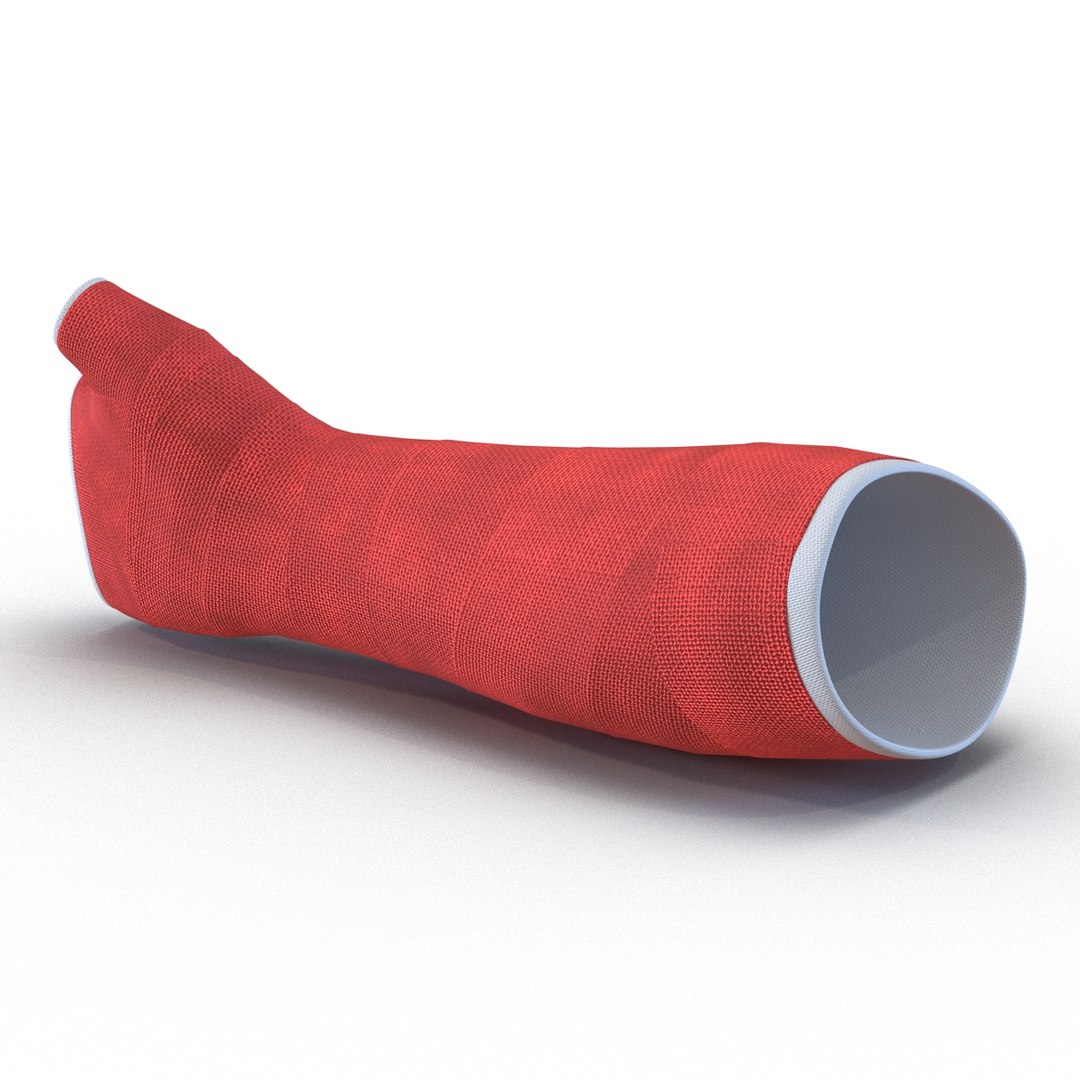 max orthopedic cast arm leg