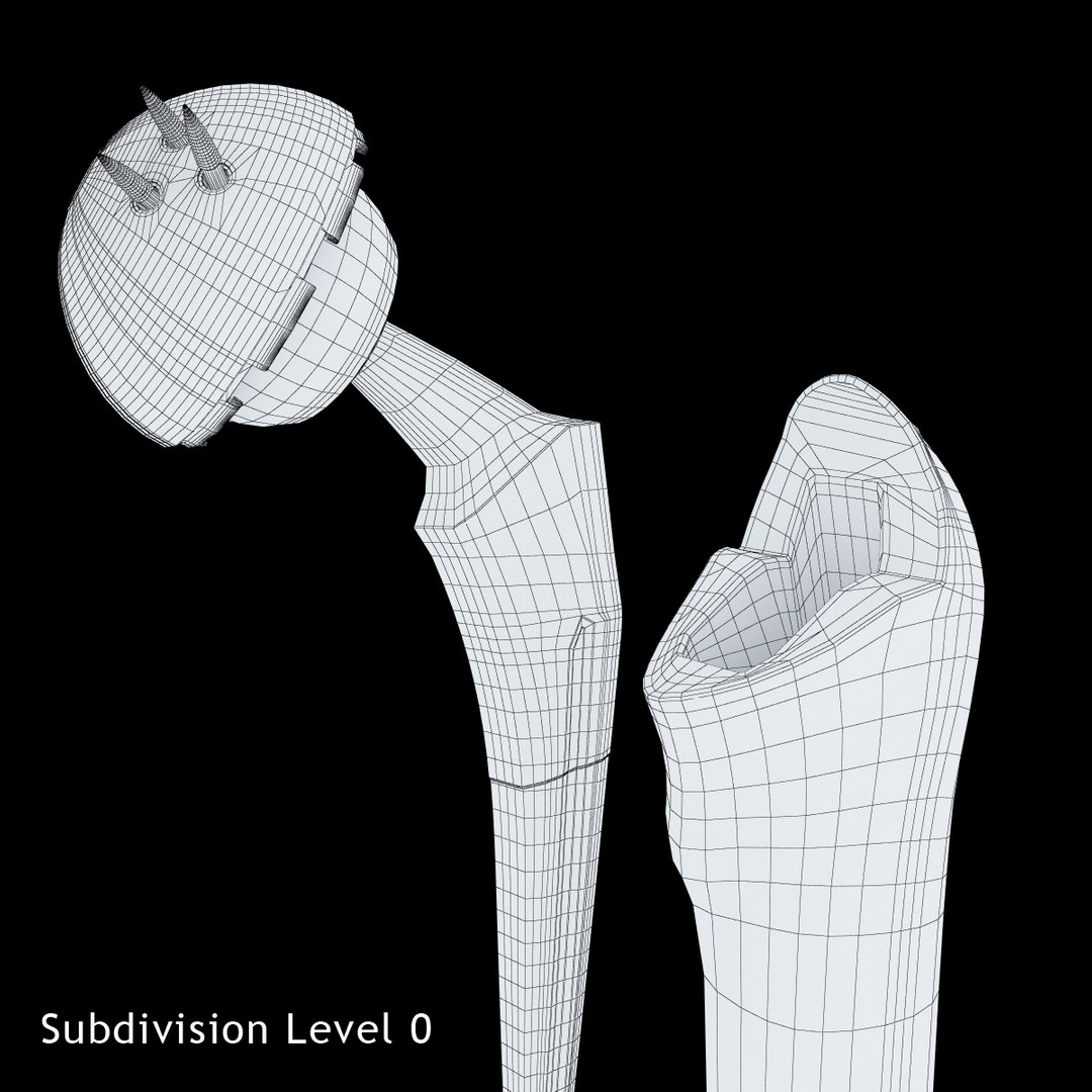 3ds Femoral Prosthesis Tibia Pelvis