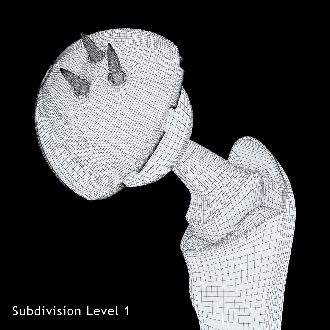 3ds Femoral Prosthesis Tibia Pelvis