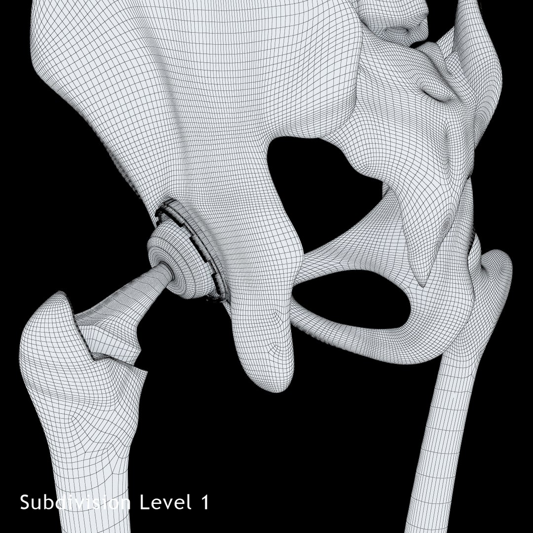 3ds Femoral Prosthesis Tibia Pelvis