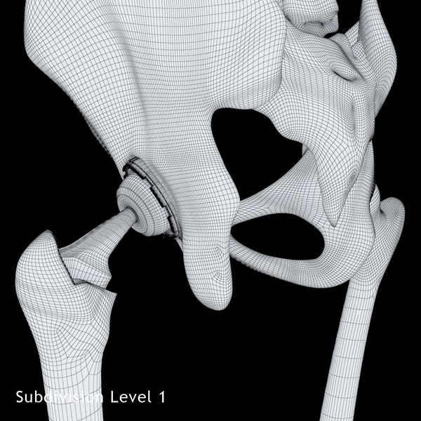 3ds femoral prosthesis tibia pelvis