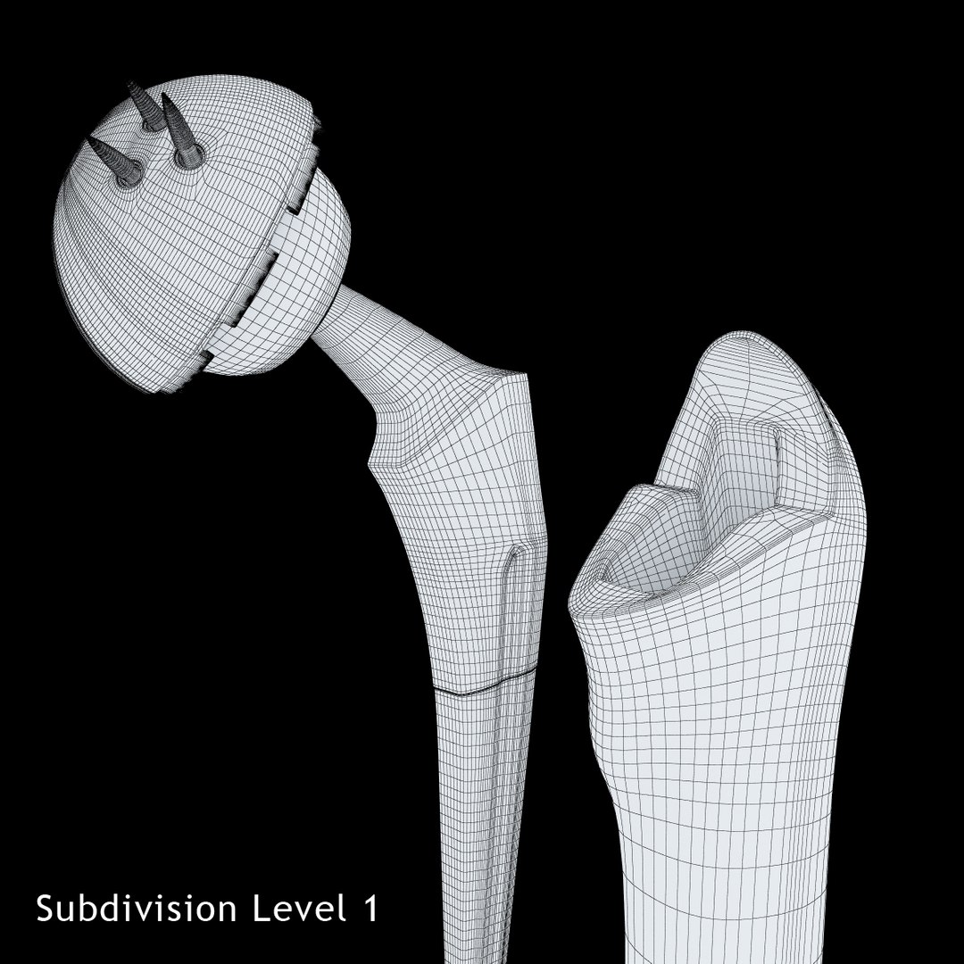 3ds Femoral Prosthesis Tibia Pelvis