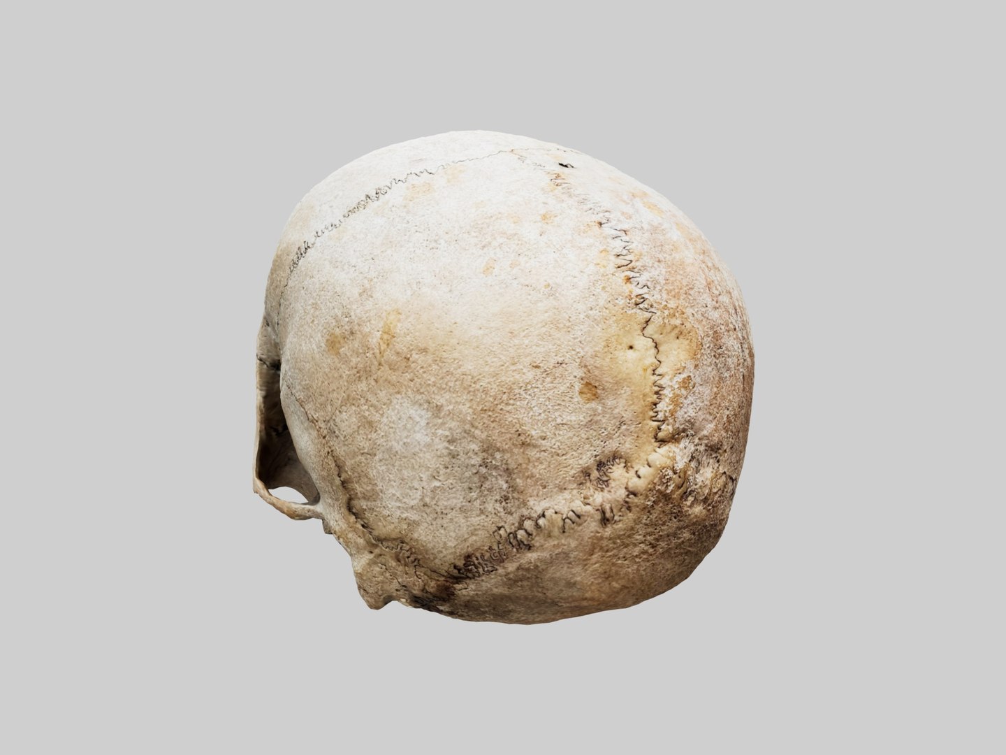 3D model Real Human Weathered Skull 3D Scan - TurboSquid 2171555