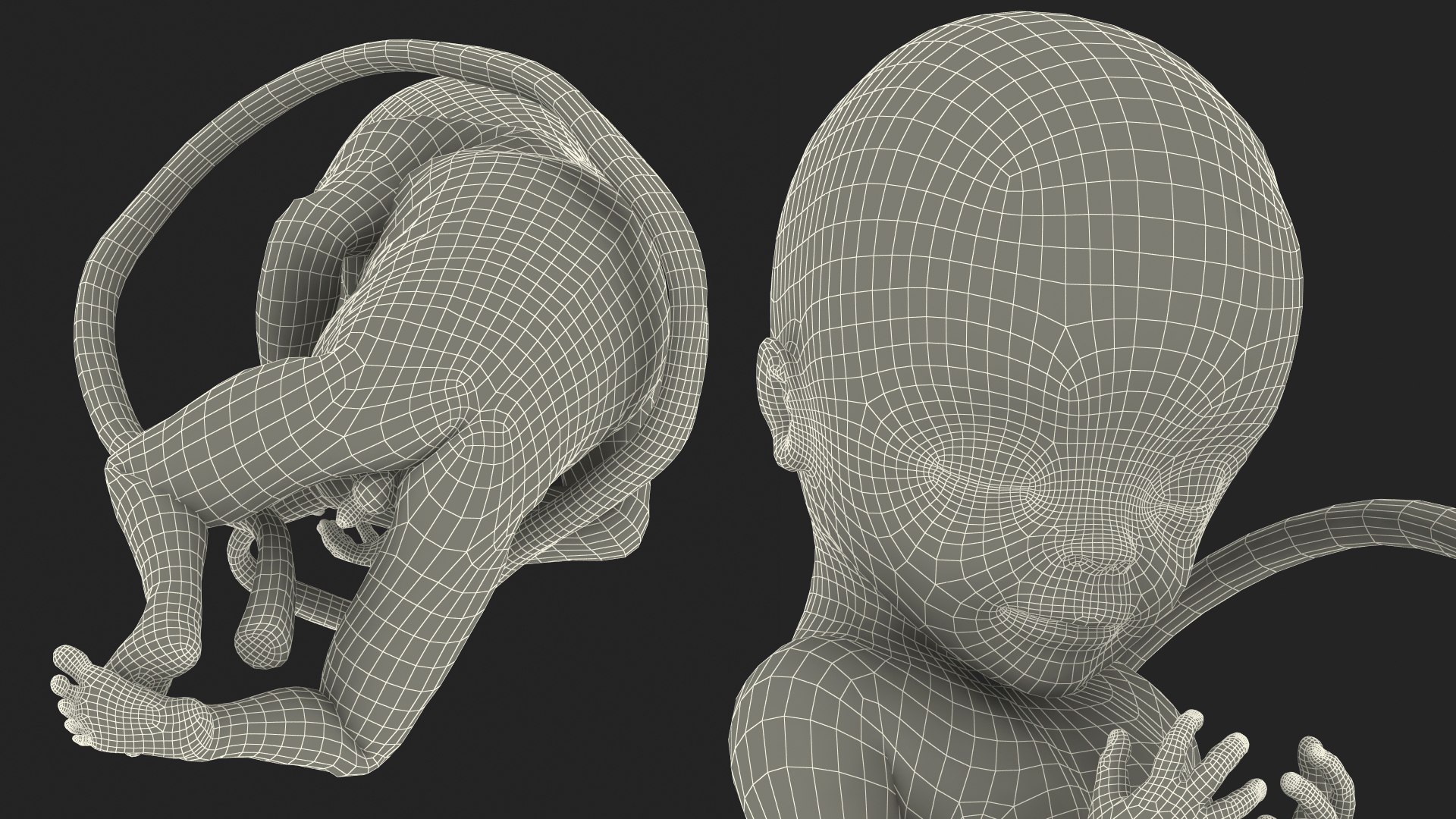 3D Human Fetus 20 Weeks Model - TurboSquid 1663033