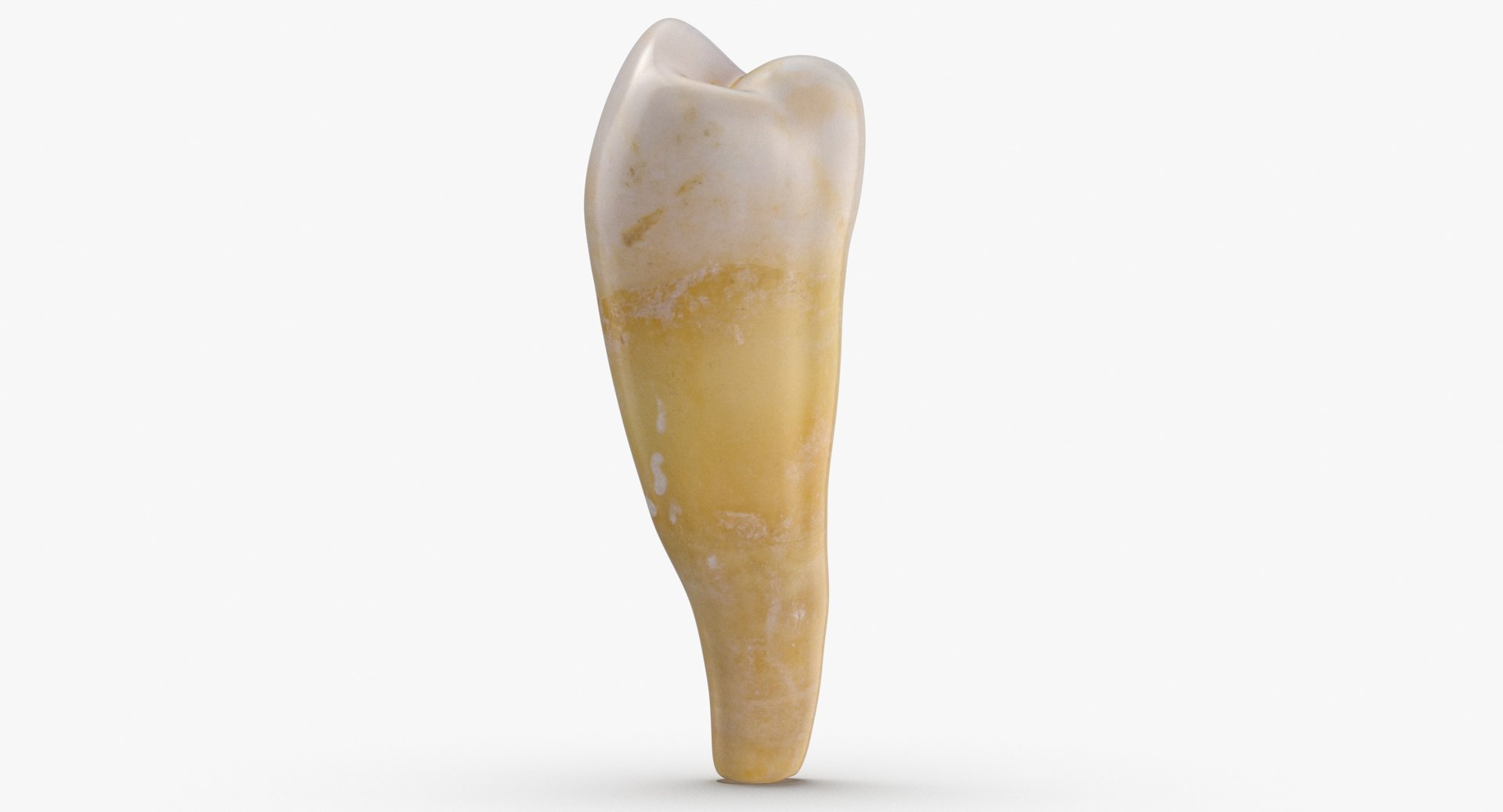 3D Human Lower Jaw Premolars Teeth Clean and Damaged Collection - 6 models - TurboSquid 1756160