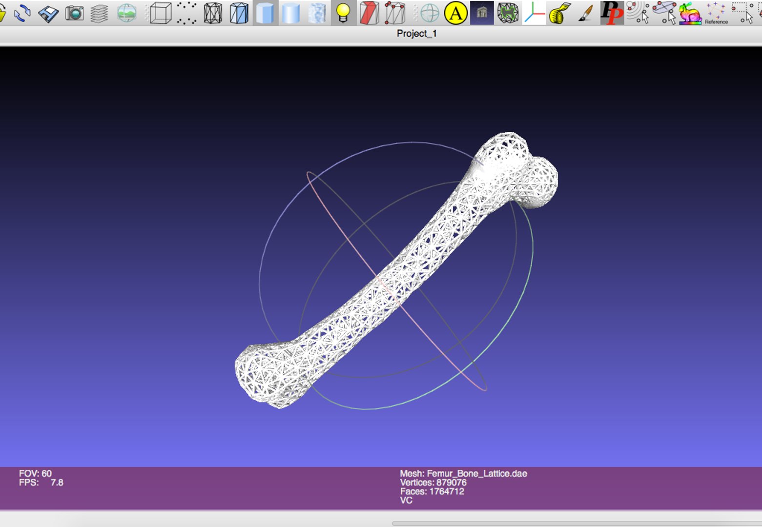 Print Femur Bone Human 3D Model - TurboSquid 1206729
