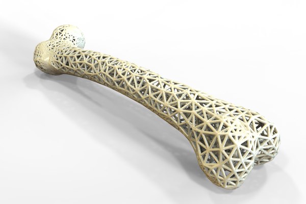 Print femur bone human 3D model - TurboSquid 1206729