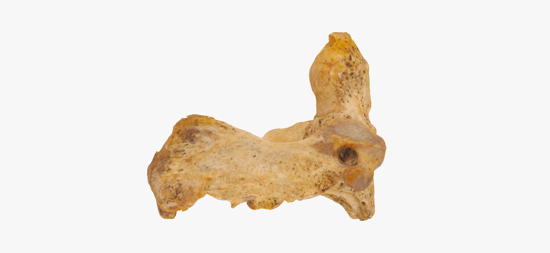 3D Model Cervical Vertebrae C2 Axis - TurboSquid 1533790