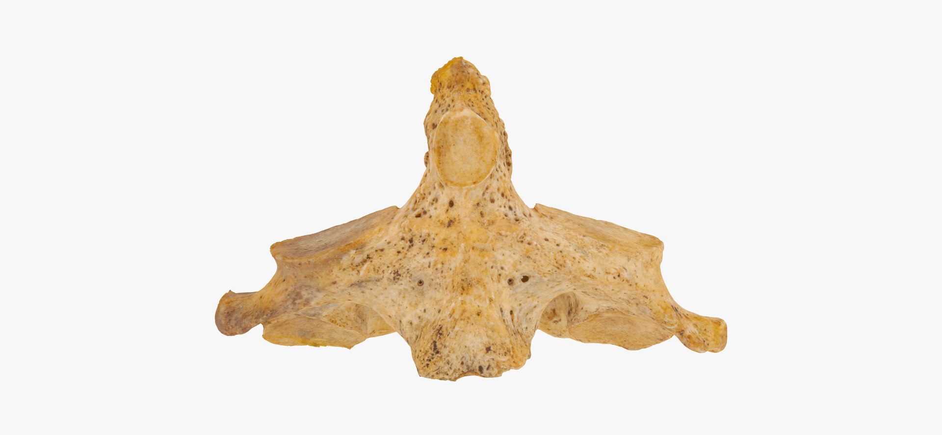 3D Model Cervical Vertebrae C2 Axis - TurboSquid 1533790