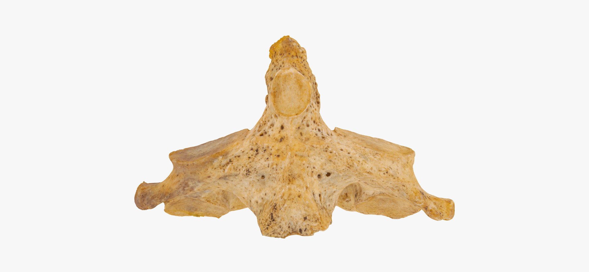 3D model cervical vertebrae c2 axis - TurboSquid 1533790
