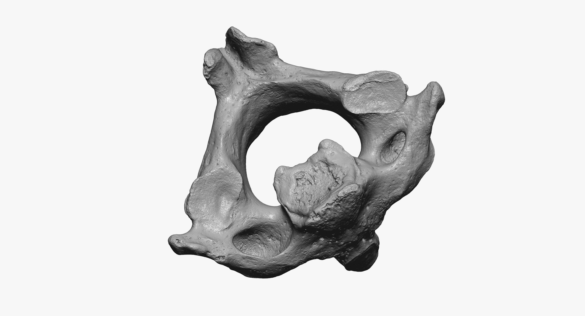 3D Model Cervical Vertebrae C2 Axis - TurboSquid 1533790