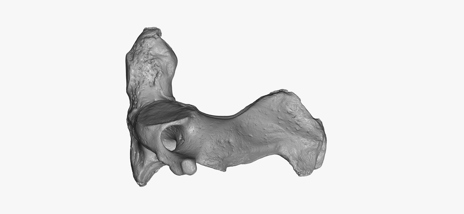 3D Model Cervical Vertebrae C2 Axis - TurboSquid 1533790