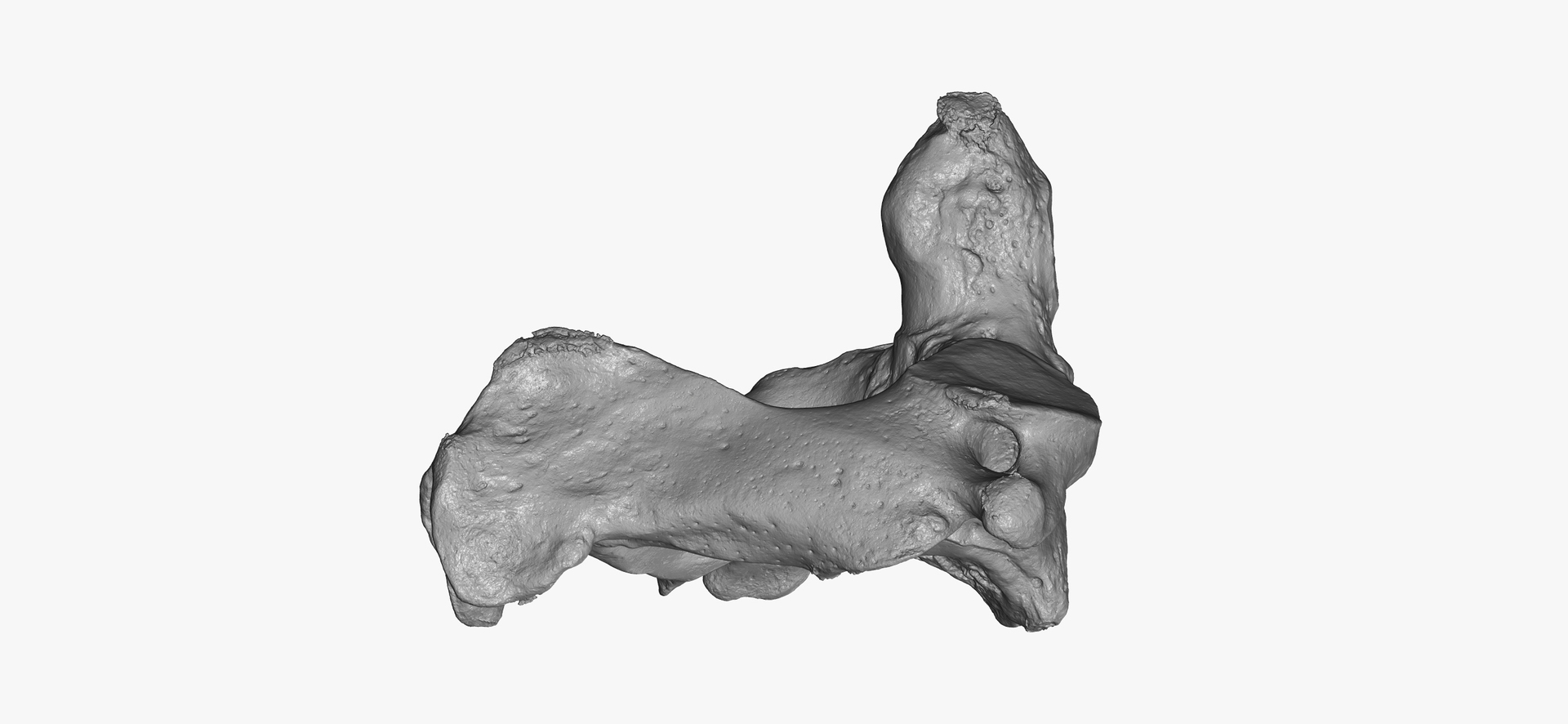 3D model cervical vertebrae c2 axis - TurboSquid 1533790