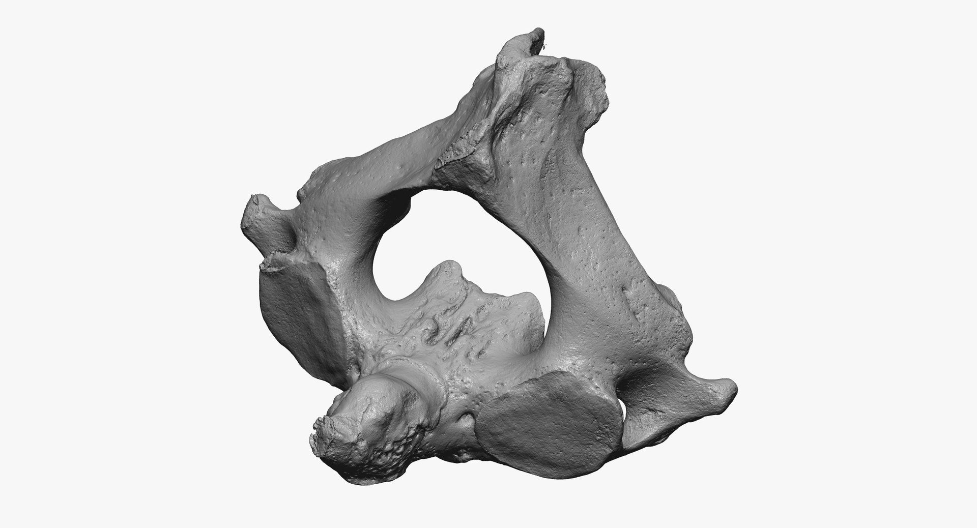 3D Model Cervical Vertebrae C2 Axis - TurboSquid 1533790