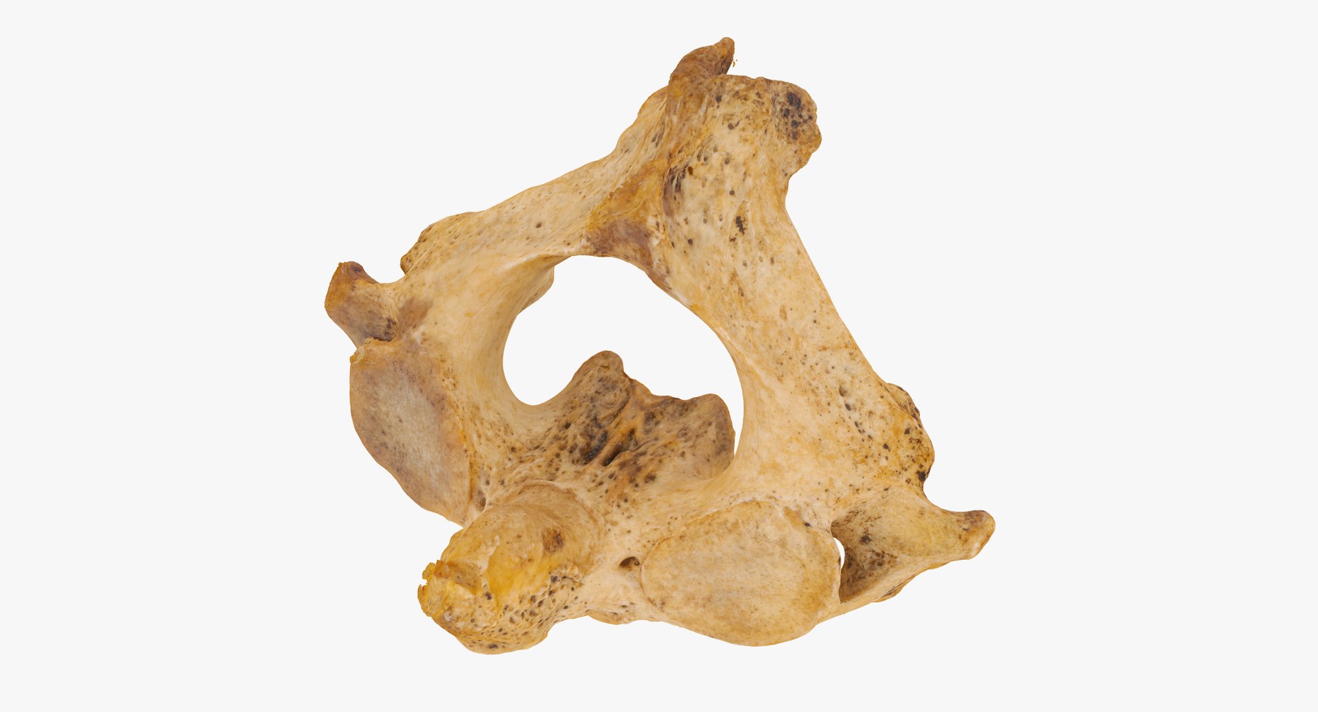 3D Model Cervical Vertebrae C2 Axis - TurboSquid 1533790