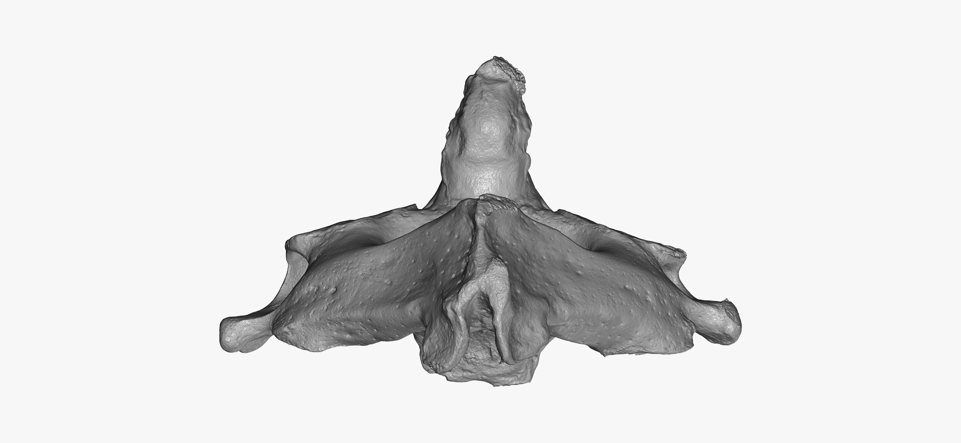 3D Model Cervical Vertebrae C2 Axis - TurboSquid 1533790