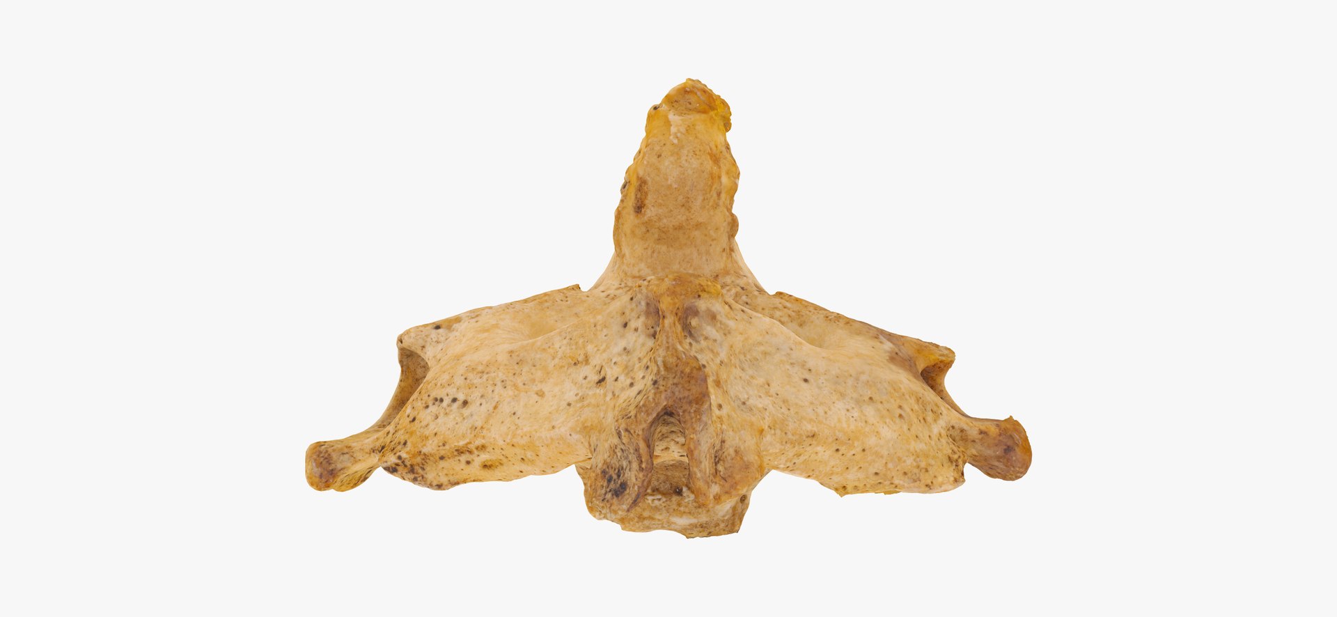 3D Model Cervical Vertebrae C2 Axis - TurboSquid 1533790