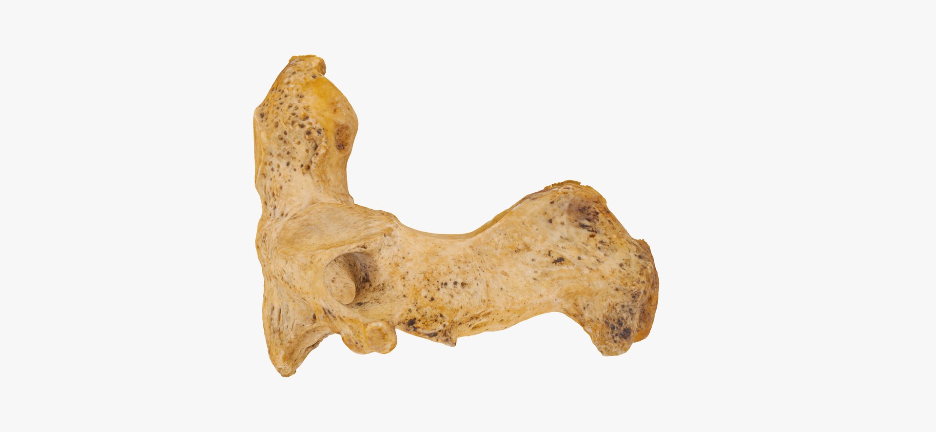 3D Model Cervical Vertebrae C2 Axis - TurboSquid 1533790