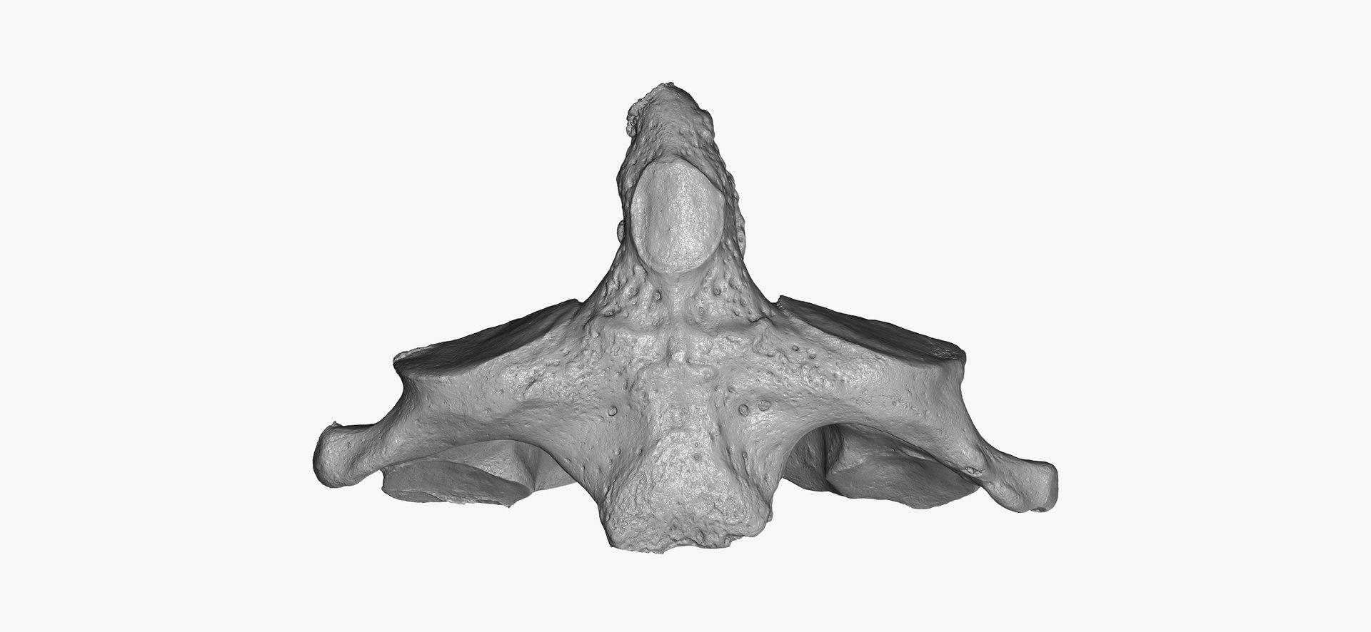 3D Model Cervical Vertebrae C2 Axis - TurboSquid 1533790