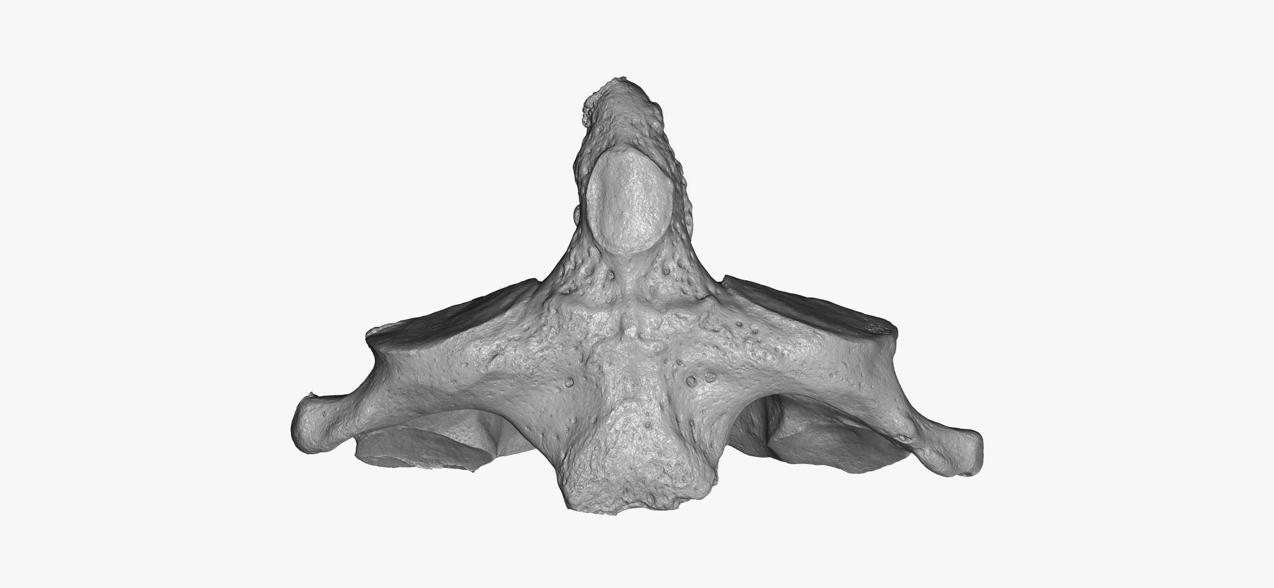 3D model cervical vertebrae c2 axis - TurboSquid 1533790