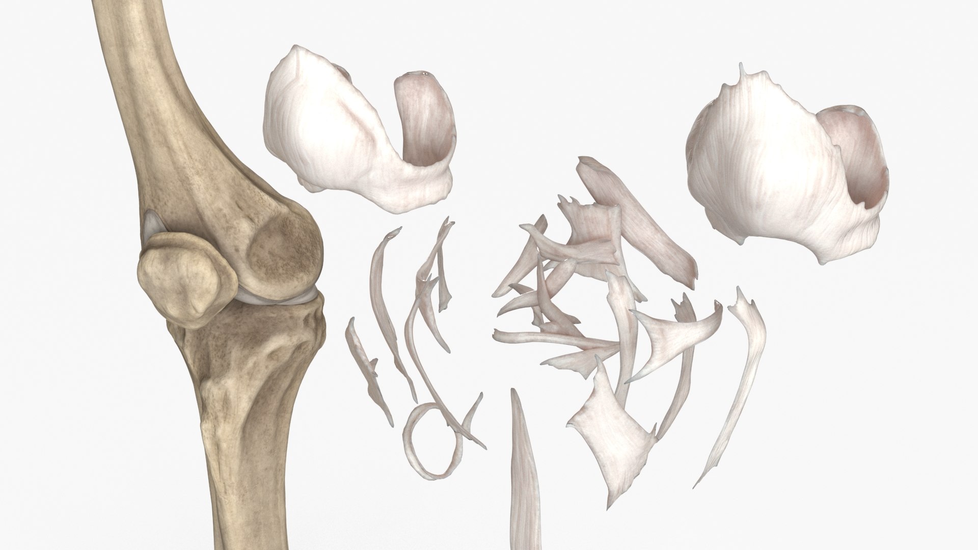 3D Human Knee Bones And Bundles - TurboSquid 1956800