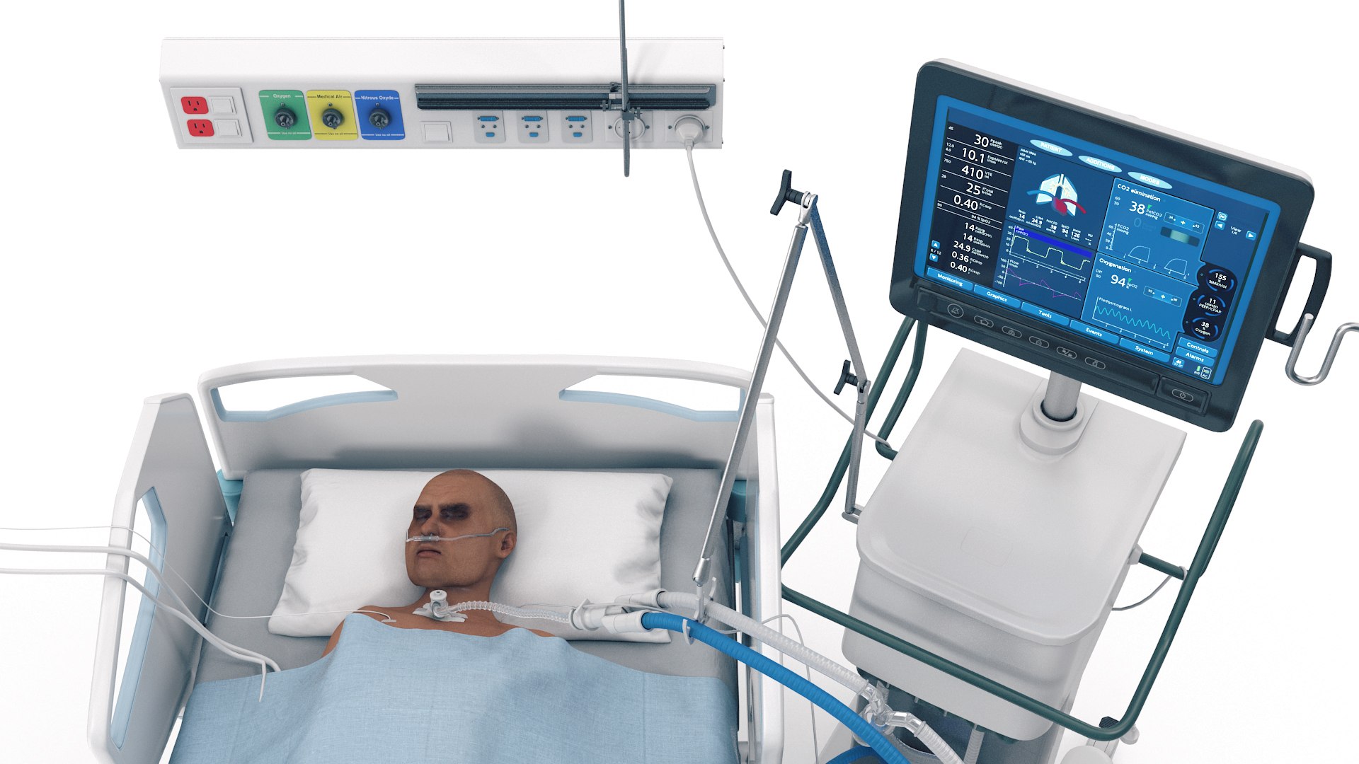 3D Patient in Intensive Care model - TurboSquid 2126080
