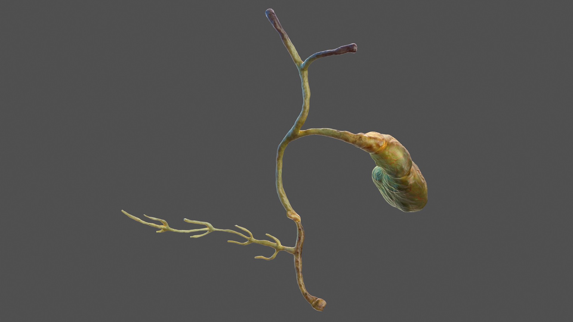 3D Human Gallbladder Gall Model - TurboSquid 1465089