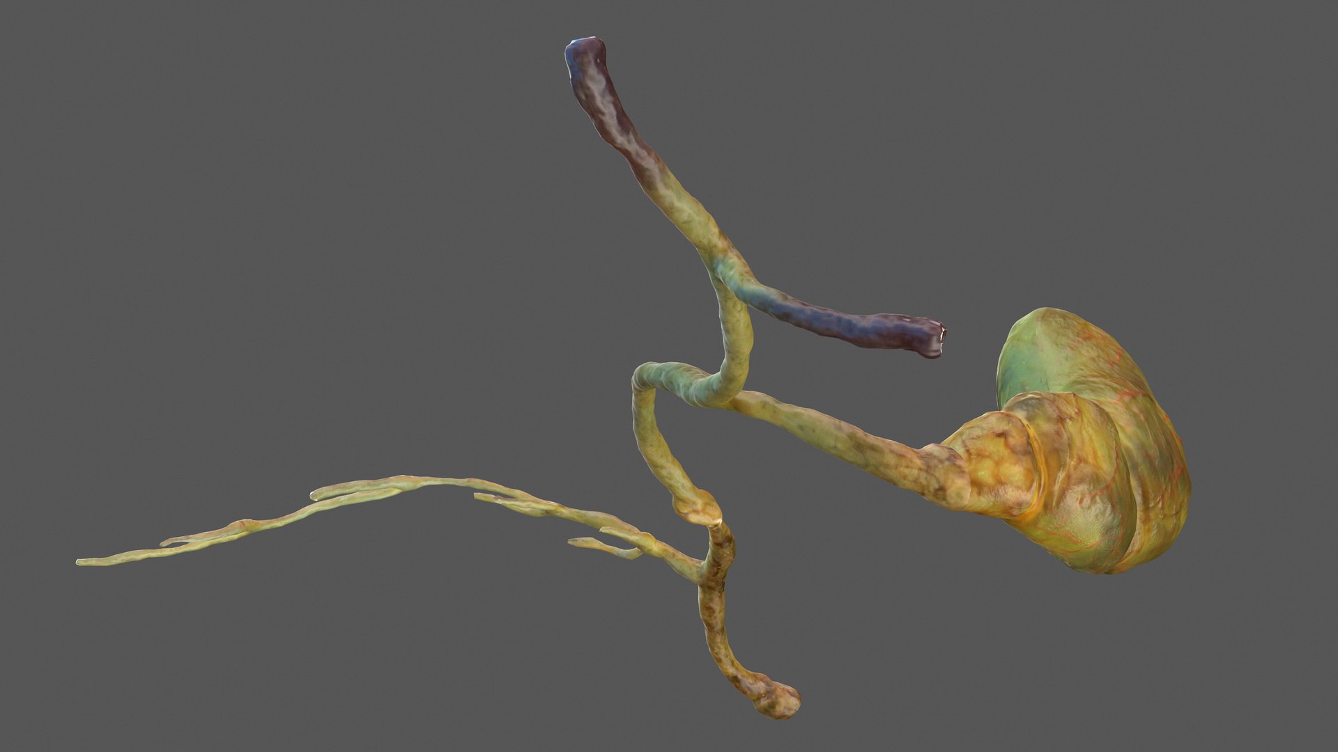3D Human Gallbladder Gall Model - TurboSquid 1465089