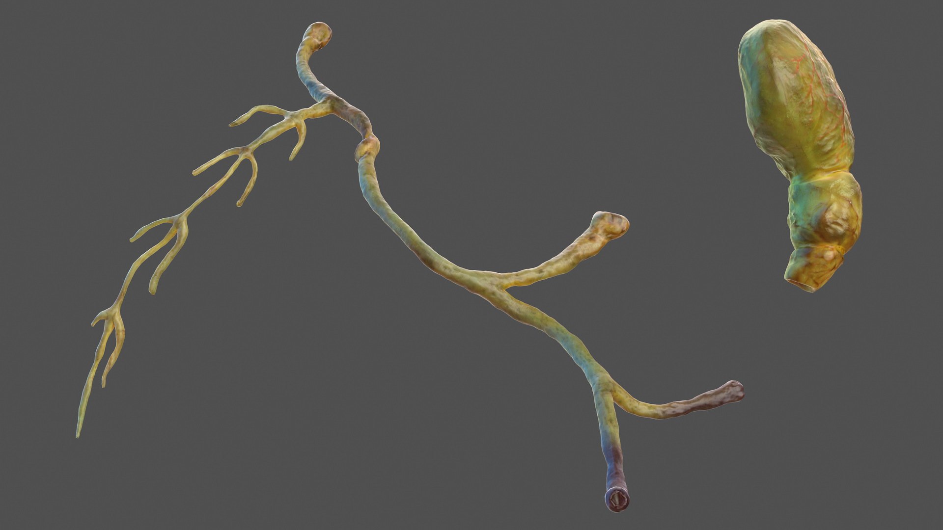 3D Human Gallbladder Gall Model - TurboSquid 1465089