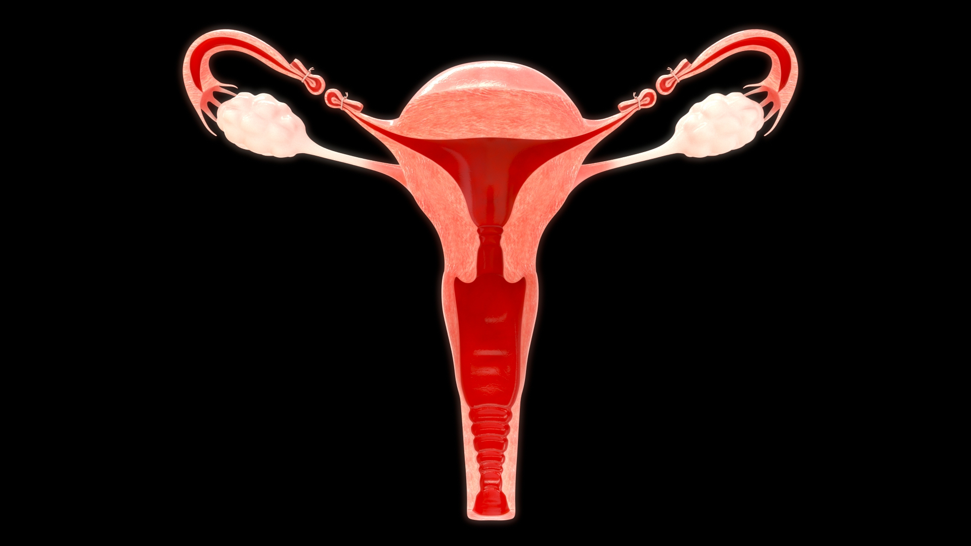 3D Tubectomy - TurboSquid 2309902