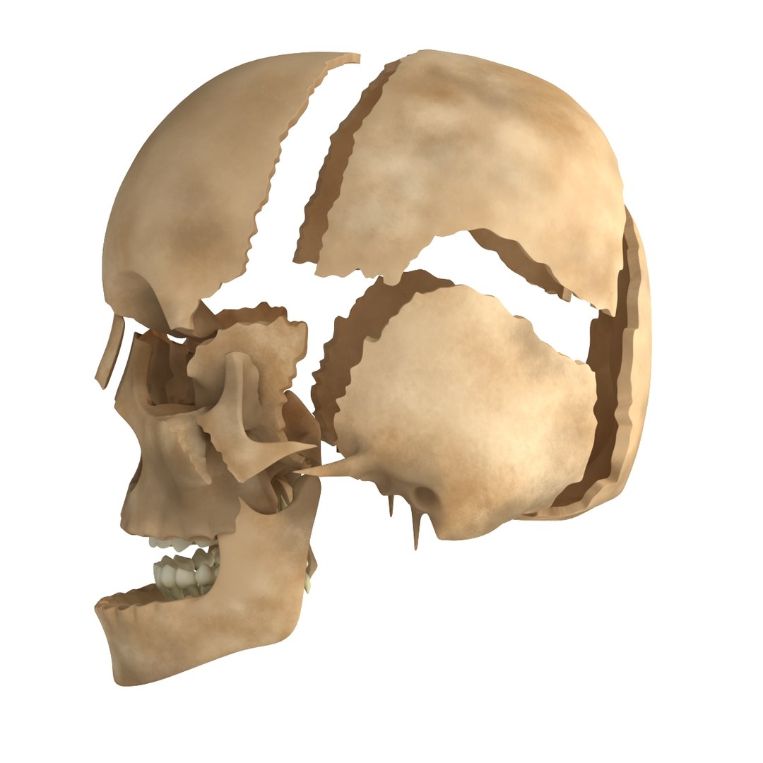 3d Model Dugm01 Human Skull Separated