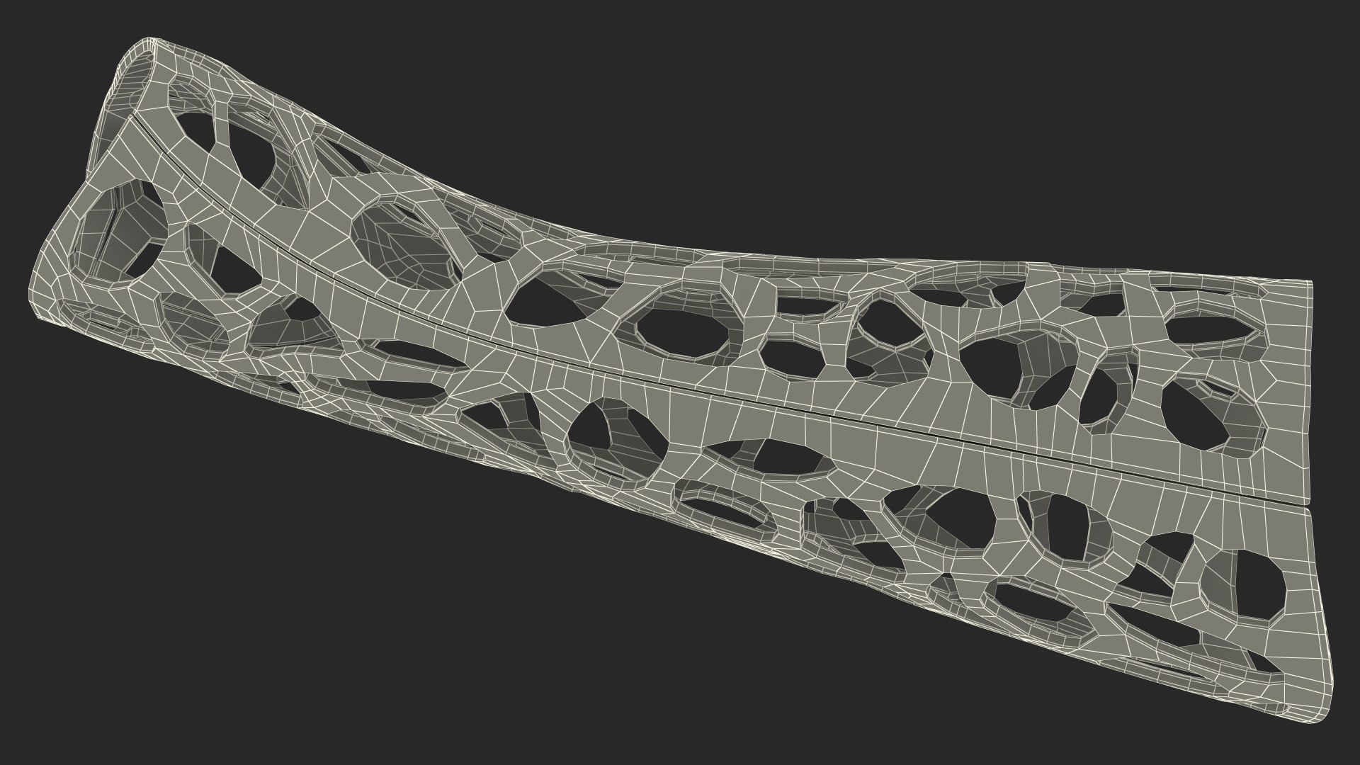 3D 3D-Printed Orthopedic Cast Hand Blue - TurboSquid 1900338