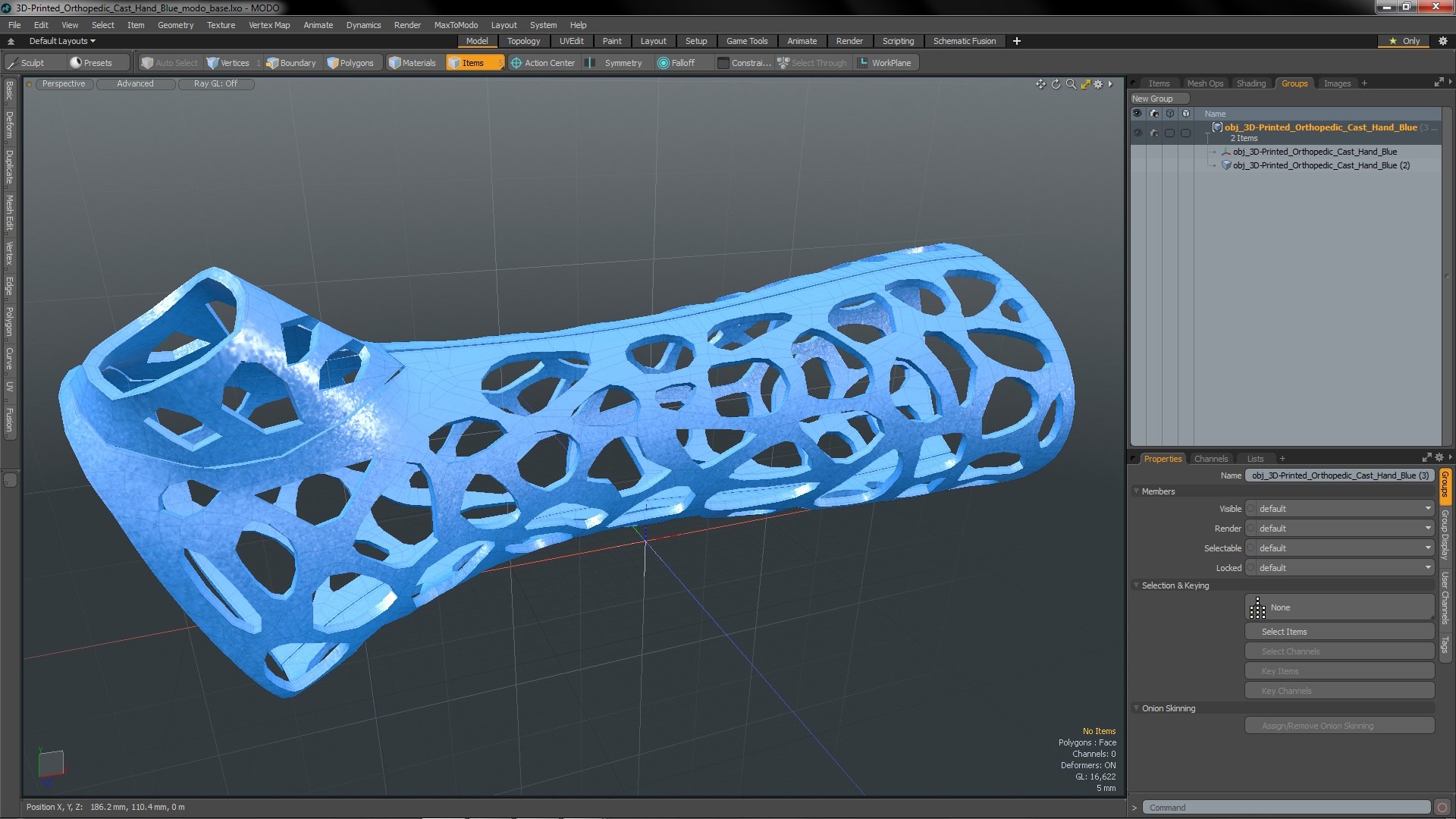 3D 3D-Printed Orthopedic Cast Hand Blue - TurboSquid 1900338
