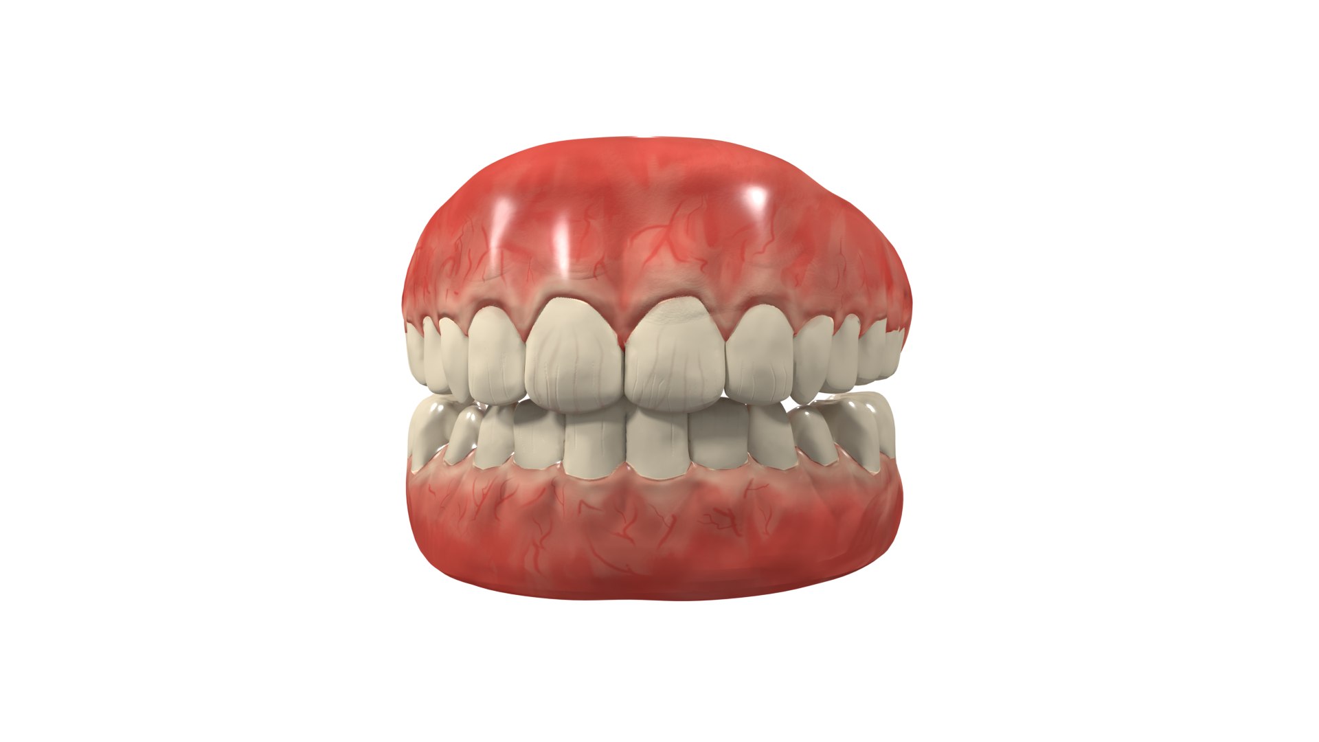 Teeth Gums 3D Model - TurboSquid 1224023
