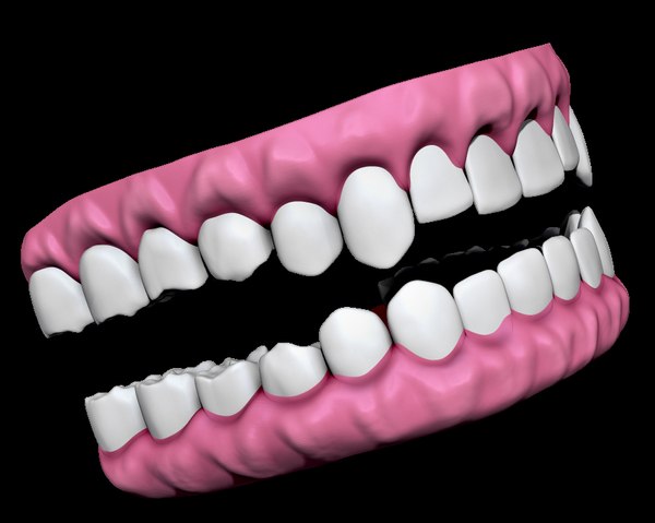 teeth 3d obj
