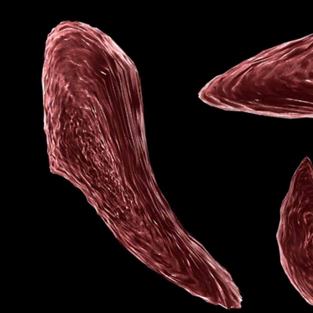 3d Model Of Blood Cells Sickle Anaemia