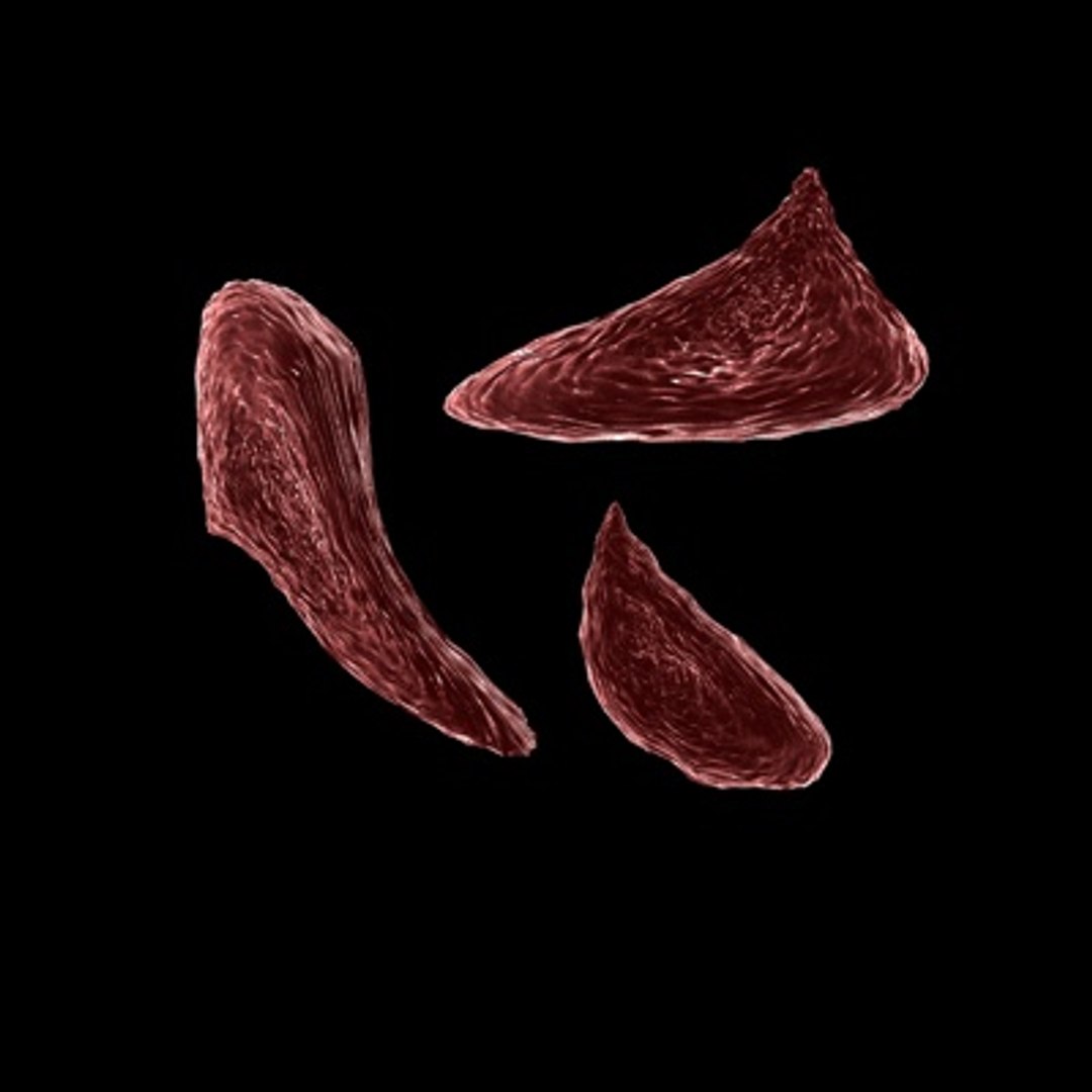 3d Model Of Blood Cells Sickle Anaemia