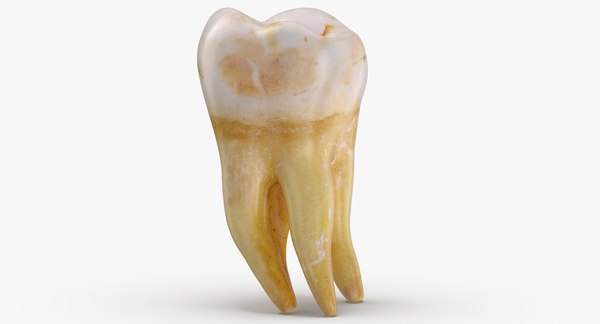 Human Molars Teeth Clean and Damaged Collection - 14 models 3D model ...
