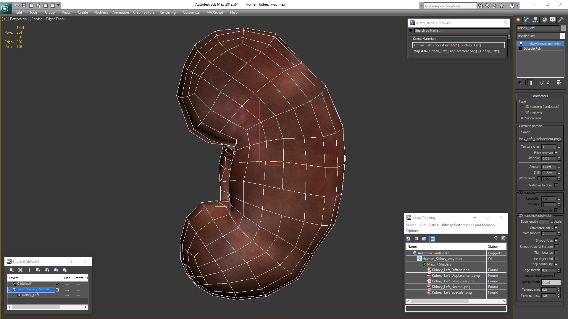 Human Kidney 3D Model - TurboSquid 1453208