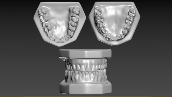 Teeth 3D print model 3D model - TurboSquid 2179179
