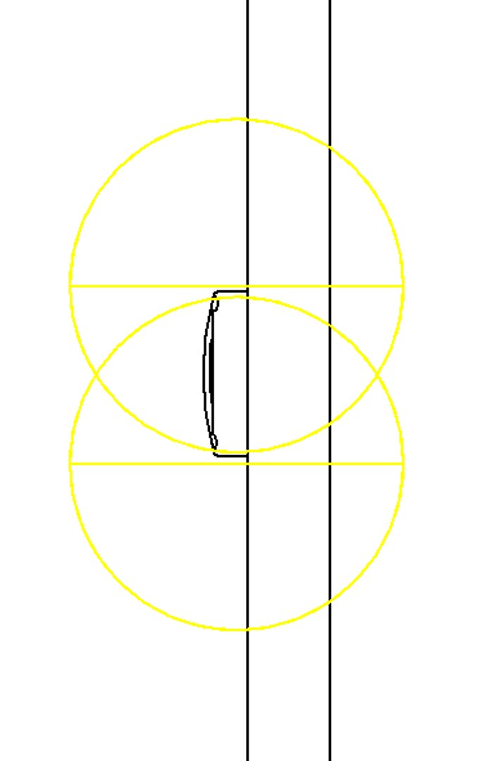 Headwall Medical Trunking 3d Model