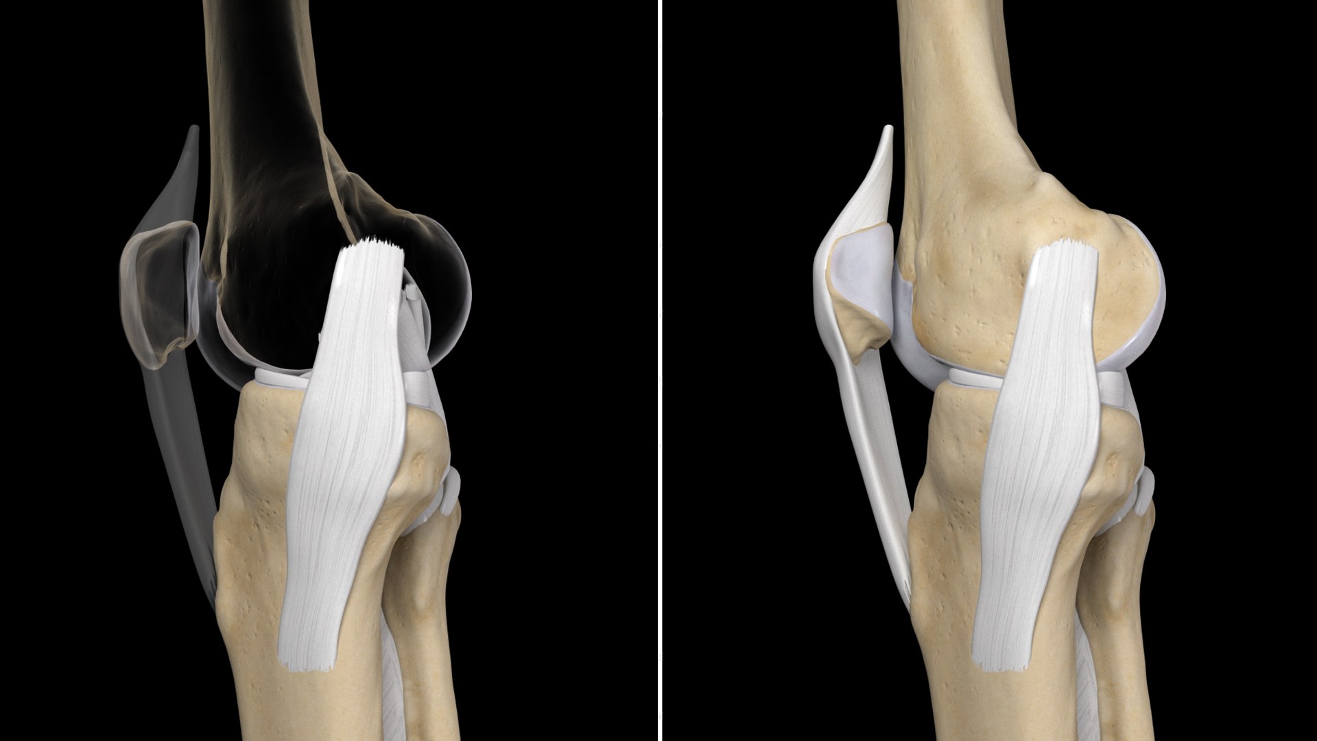 High Resolution Human Knee From A Real CT-Scan Model - TurboSquid 1949197