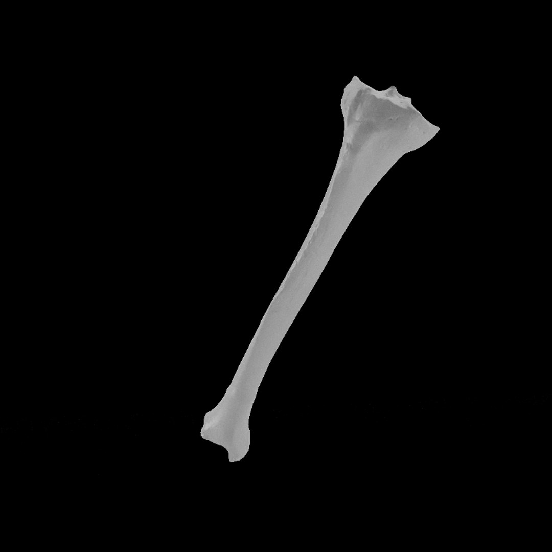 3D Human Tibia Model - TurboSquid 1234604