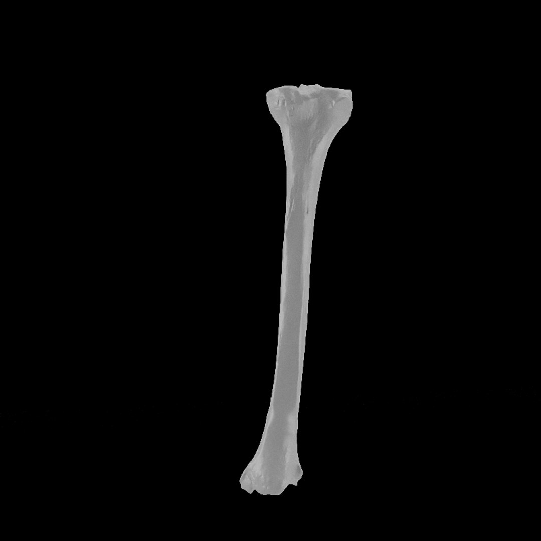3D Human Tibia Model - TurboSquid 1234604