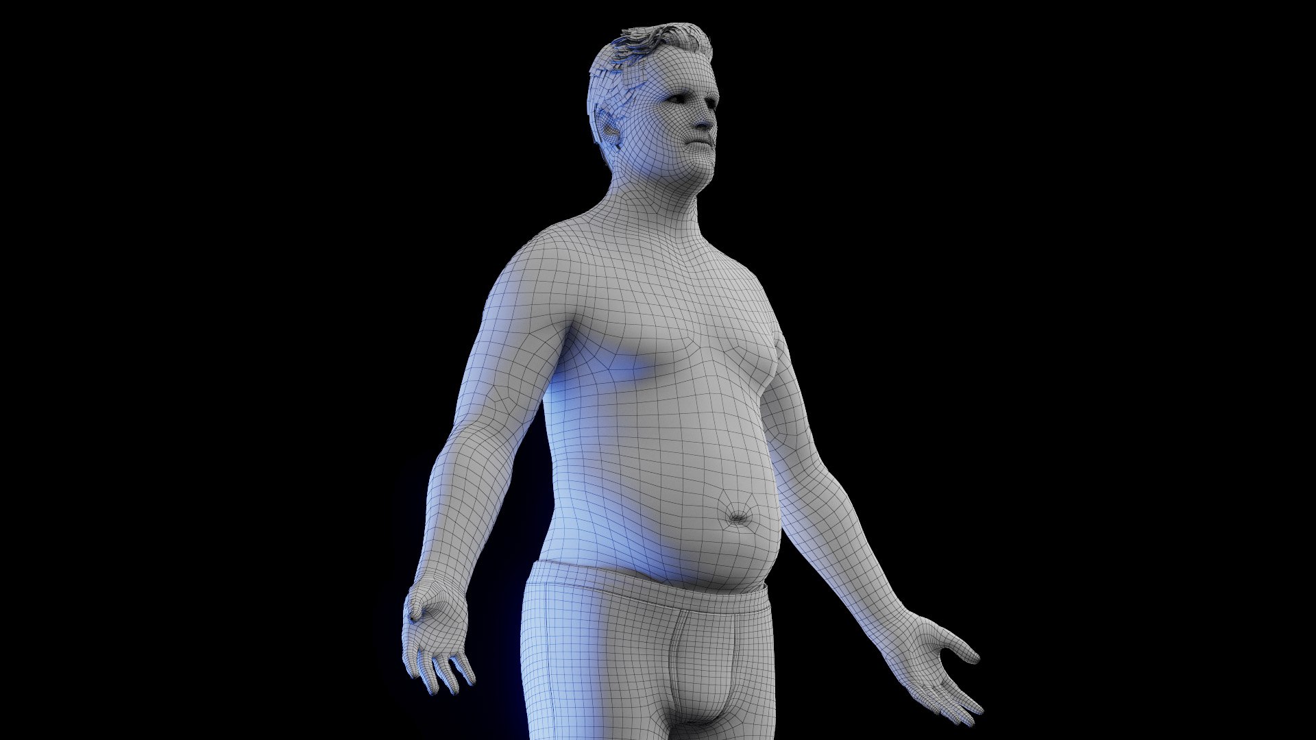 3D Model Human Anatomy Obese Male Body - TurboSquid 2028908