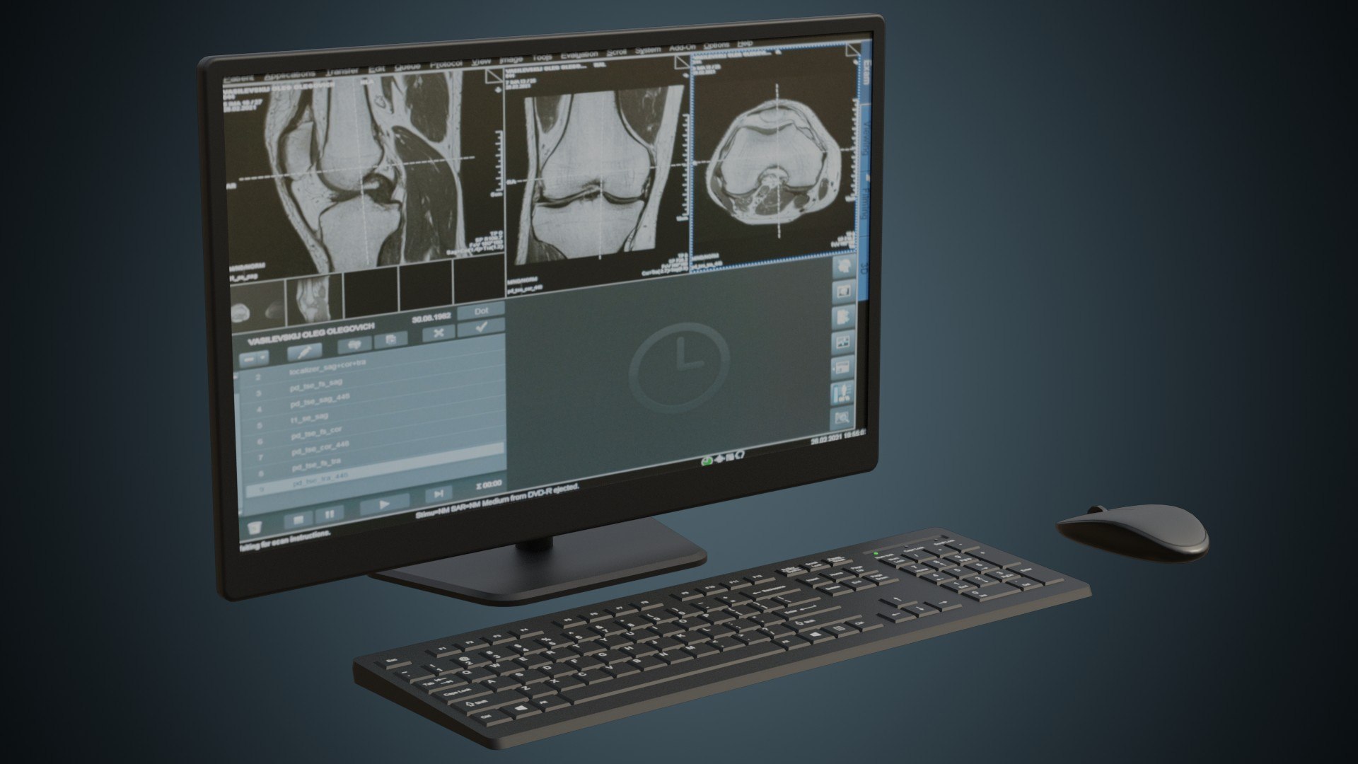 Medical Computer 2 Basic 3D Model - TurboSquid 2134507