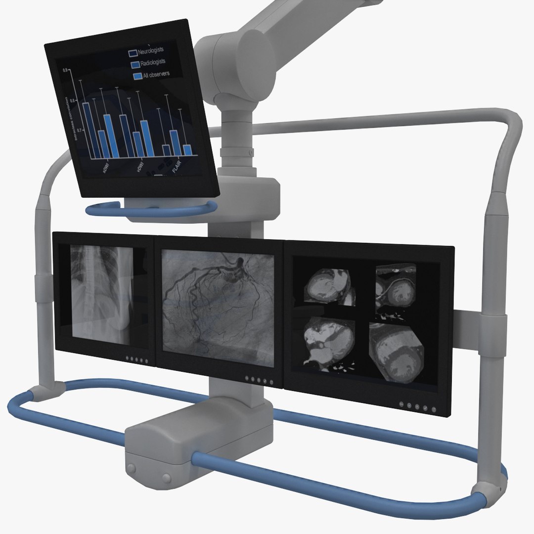 artis angiography 3d 3ds