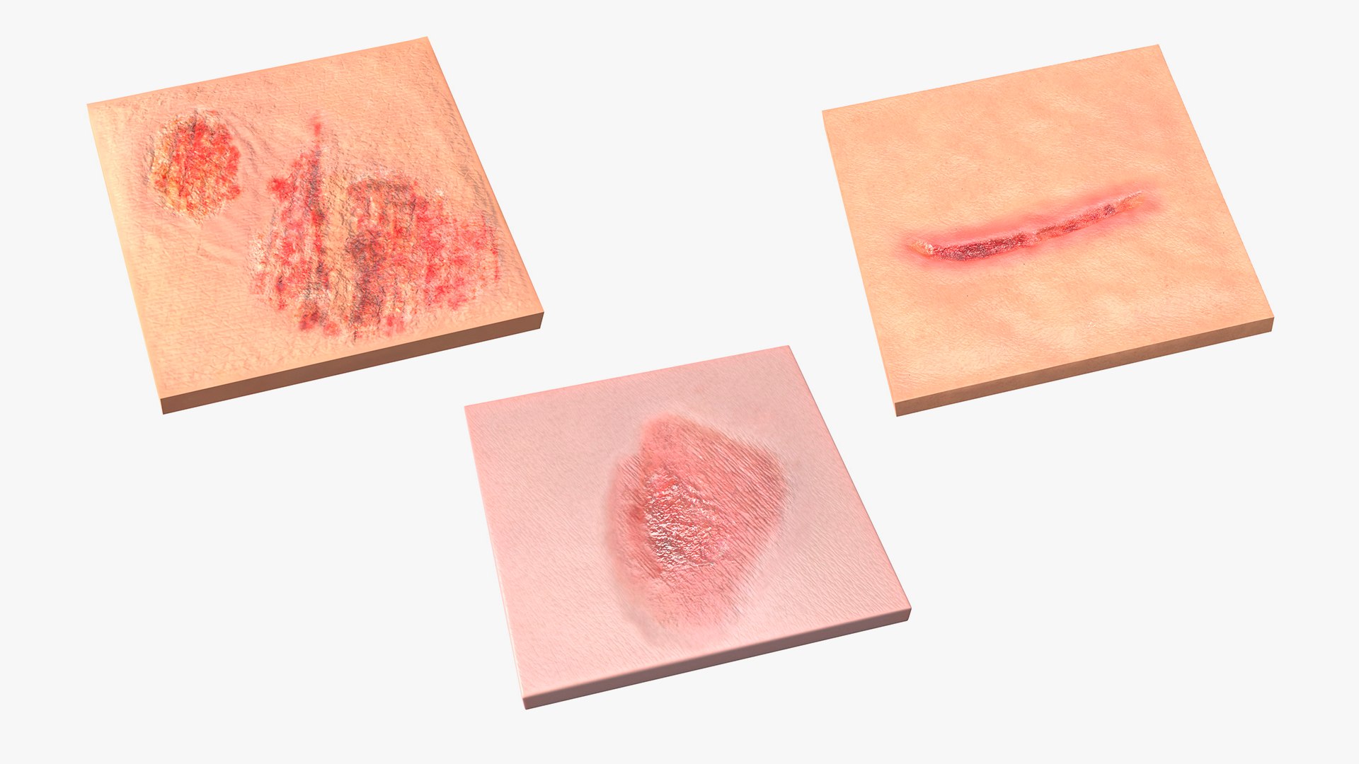 3D Model Skin Surfaces Collection - TurboSquid 2169251